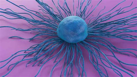 5 Basic Ways To Prevent Cervical Cancer Womens Health