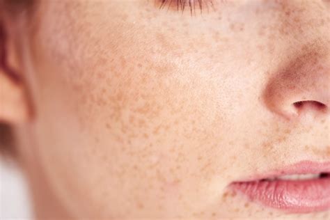 How Does The Skin Function Urgo Medical Will Tell You More About It