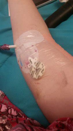 Picc Line Girls BabyCenter