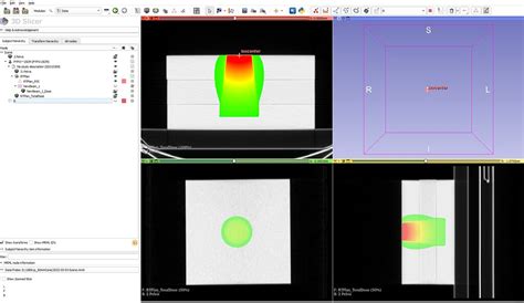 Isodose Module Not Showing Colorwash Support 3d Slicer Community