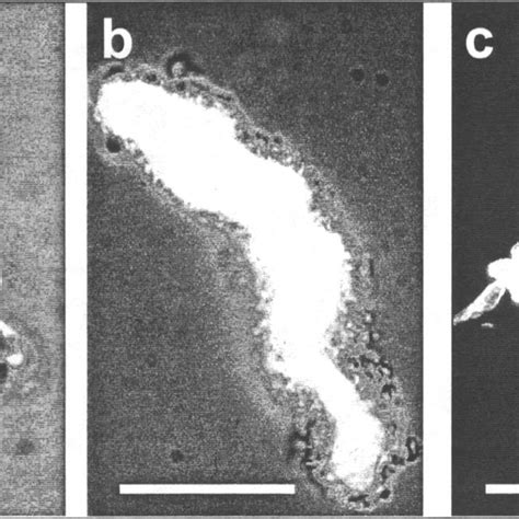 The Three Types Of Oil Mineral Aggregates As Seen In Combined Uv