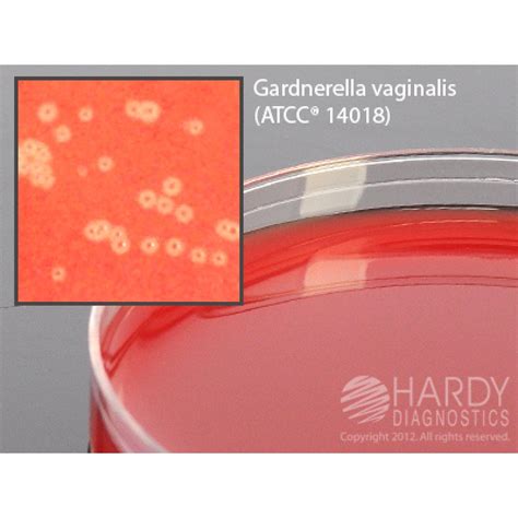 Hardy Diagnostic A80 Dry Culture Media V Agar G Vaginalis Plate 42