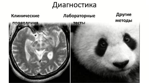 Болезнь Вильсона Коновалова Youtube