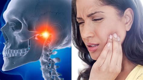Arthrocentesis Wash Out Of Jaw Joint Injection Tmj Arthroscopy