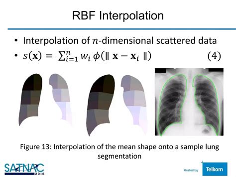 Tb Detection Using Modified Local Binary Pattern Features Ppt