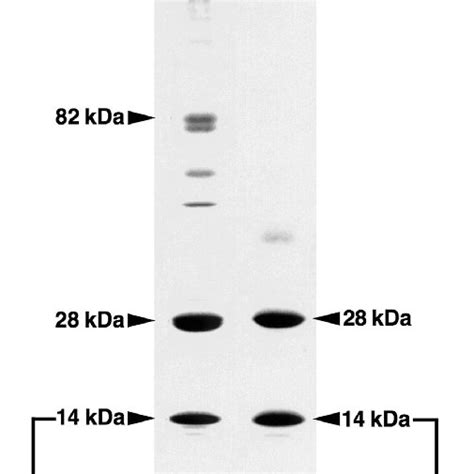 Sds Page Of Ldls And Hdls Ldls And Hdls Were Isolated From The Plasma