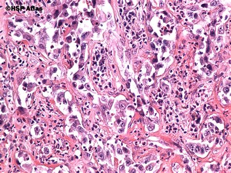 Hsp Atlas Histopathology Atlas Endocrine
