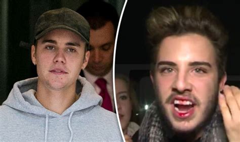 Justin Bieber Leaves Fan Bleeding After Punching Him In The Face Celebrity News Showbiz