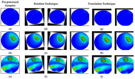 Brain Tumor Segmentation And Classification From Sensor Based Portable Microwave Brain Imaging