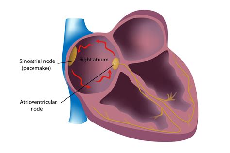 Topic Atrial Flutter 12 Lead Ecg Course Acls Certification Association Topic Atrial Flutter 12 Lead Ecg Course Acls Certification Association