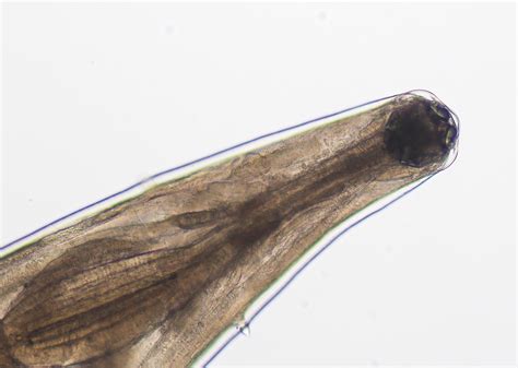 Pathology Outlines Hookworm