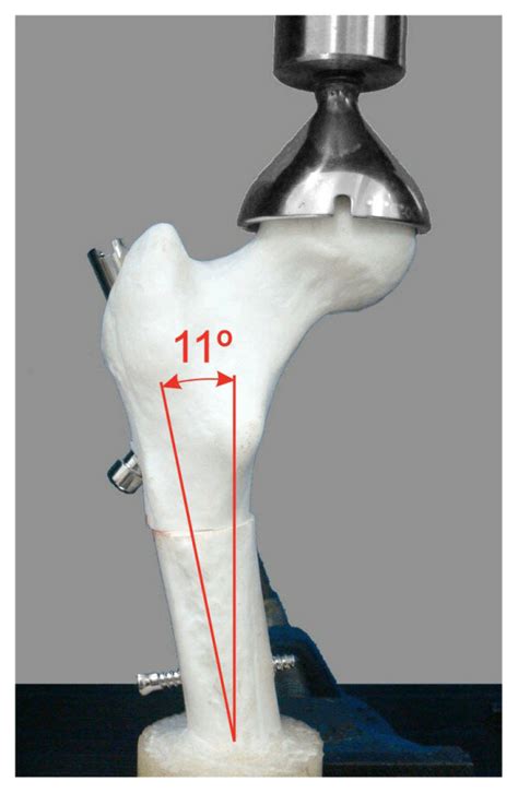 Femoral Model Within The Testing Machine For Bending Compression Test Download Scientific