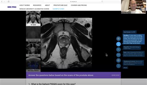 Online Prostate Mri Trainer Mri Pro