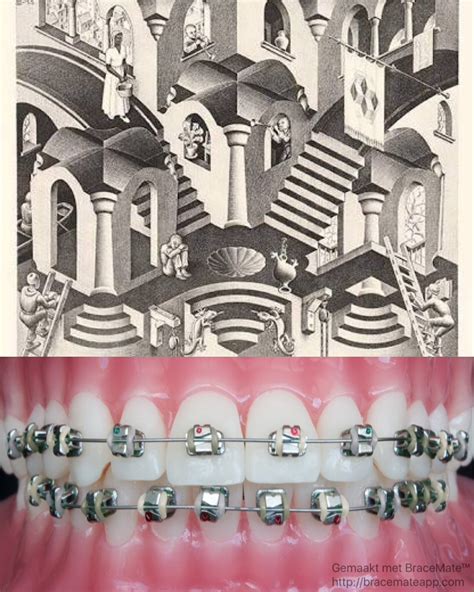 Mc Escher Braces Colors Endoprepapp