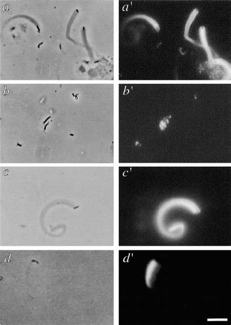 Vasp Is Essential For Actin Based Motility Of Listeria In Platelet