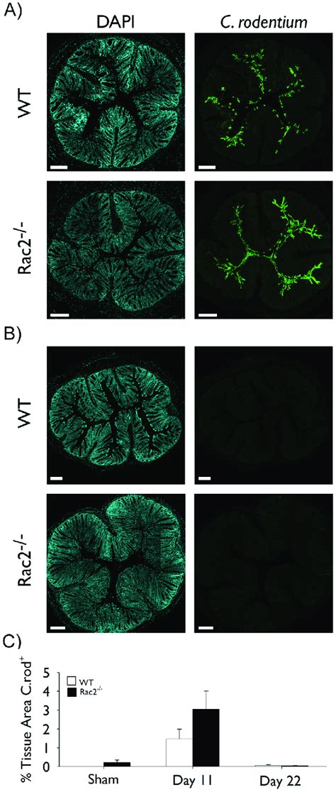 Epithelial Associated Citrobacter Rodentium Is Cleared By Wt And Rac2