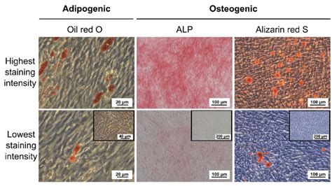 Microscopical Evaluation Of The Differentiation Potential Of Dpscs