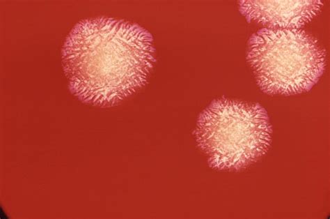Fusobacteria