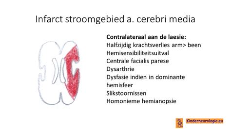 Cva Kinderneurologie