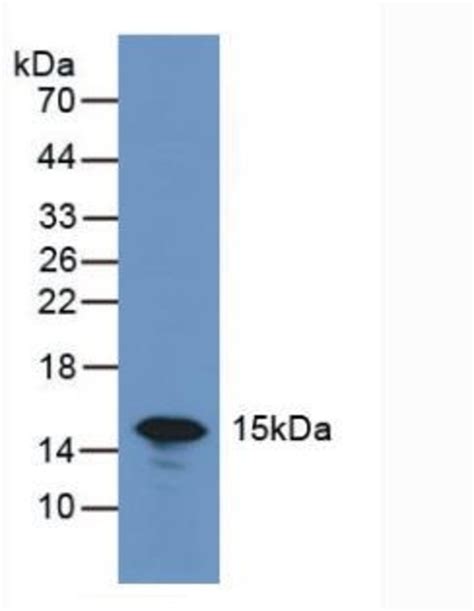 Galectin 7 Polyclonal Antibody Invitrogen Antibodies Primary