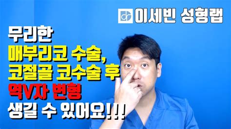 무리한 매부리코 수술 코절골 코수술 후 역v자 변형 생길 수 있어요 Youtube