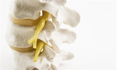 Root Blocks For Wesley Chapel Zephyrhills Brandon Riverview Ormond Beach Port Orange Tampa