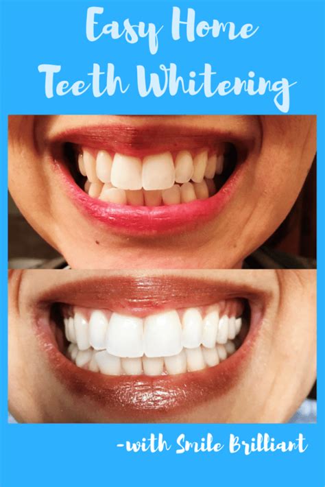 Easy Home Teeth Whitening For A Coffee Addict Giveaway