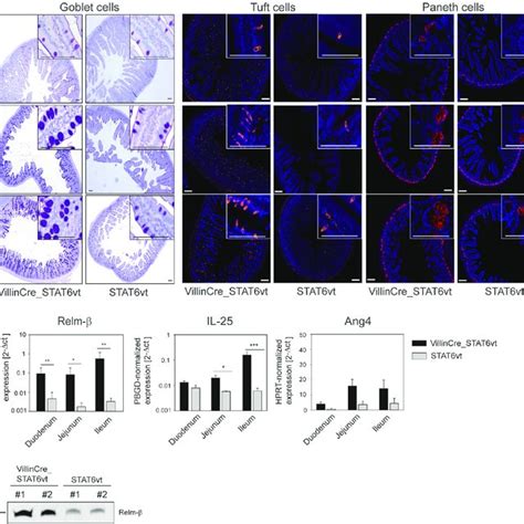 Increased Numbers Of Secretory Intestinal Epithelial Cells In