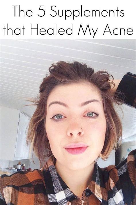 The 5 Supplements That Healed My Acne Naturally Natural Acne