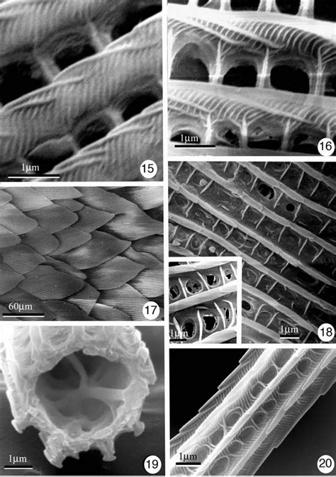 To 20 Scanning Electron Micrographs Of Scales And Bristles Of