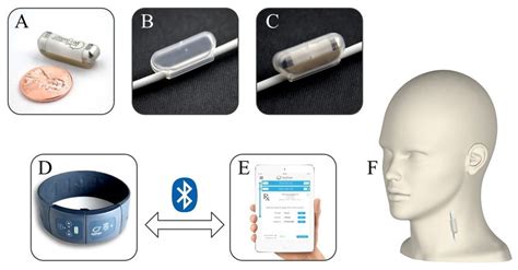 Setpoint Medicals Wirelessly Rechargeable Closed Loop Vagus Nerve Download Scientific Diagram