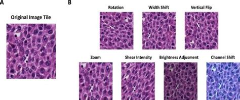 On Histology Images Data Augmentation Is Used Download Scientific Diagram