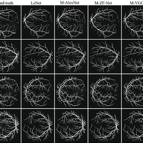 Segmentation Results Using The Different Models On Drive Download
