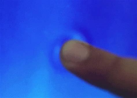 Whenever I Move My Right Eye Fast From Place To Another I See A Spot