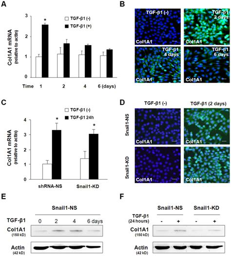 Col1a1 Production And Apoptotic Resistance In Tgf β1 Induced Epithelial
