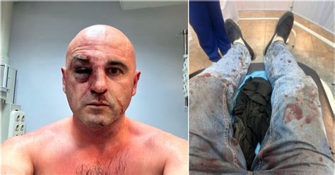 ლევან ხაბეიშვილს სასტიკად სცემეს