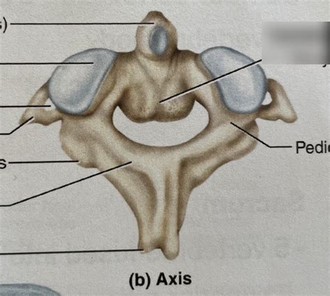 Axis C2 Vertebra Diagram Quizlet