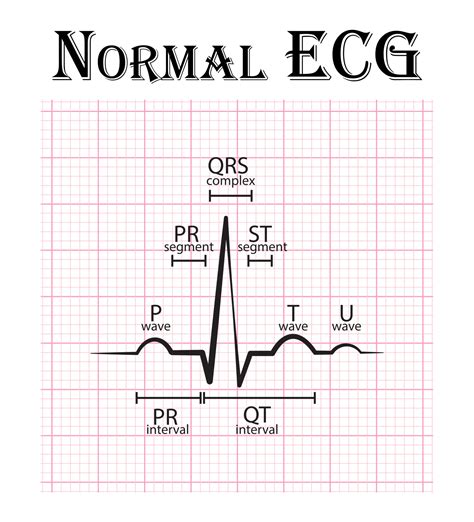 Tabla De Electrocardiograma Ecg Normal 2268232 Vector En Vecteezy