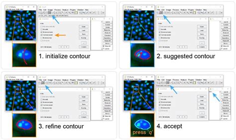 How To Merge Two Images In Imagej Software Online Tysenturin