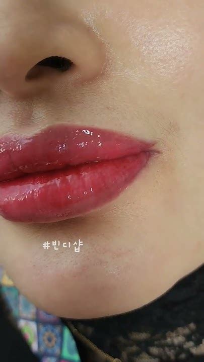입꼬링올리고 입꼬리성형 입꼬리쳐진입술 입꼬리 올리고💃해드립니다예약문의📱01031663666전화문의는 Pass