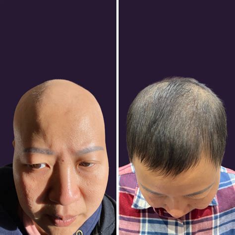 General ODE Dermatology