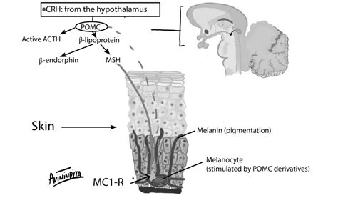 Effect Of Acth On Melanogenesis My Endo Consult