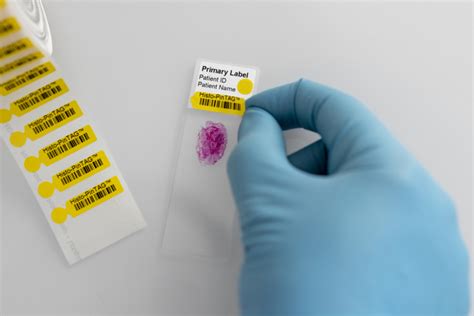Microscope Slide Over Labeling Labtag