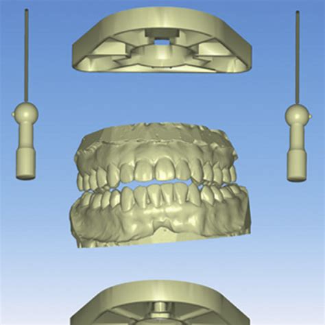 Mandible In Centric Relation Occlusion And Maximal Intercuspal Position