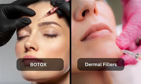 What Is The Difference Between Botox And Dermal Fillers