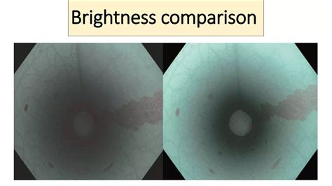 Narrow Band Imaging Pptx