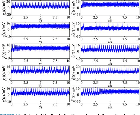 Figure 1 From Design Of Pinning Control Strategies Of Different Neural