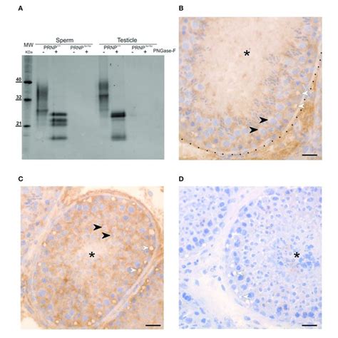 Prp C Is Expressed In Testicular Tissue And Spermatozoa Prp C Was Download Scientific