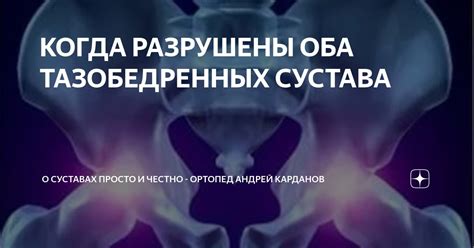 КОГДА РАЗРУШЕНЫ ОБА ТАЗОБЕДРЕННЫХ СУСТАВА О СУСТАВАХ ПРОСТО И ЧЕСТНО ортопед Андрей Карданов