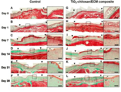 Histological Micrographs Of Wound Sections Implanted With G L Or